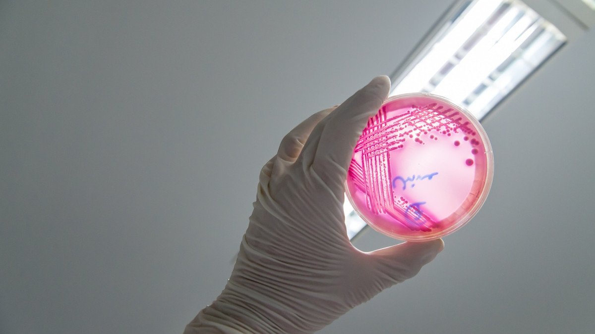 EHEC-Ausbruch: RKI bestimmt seltenen Erregerstamm | APOTHEKE ADHOC