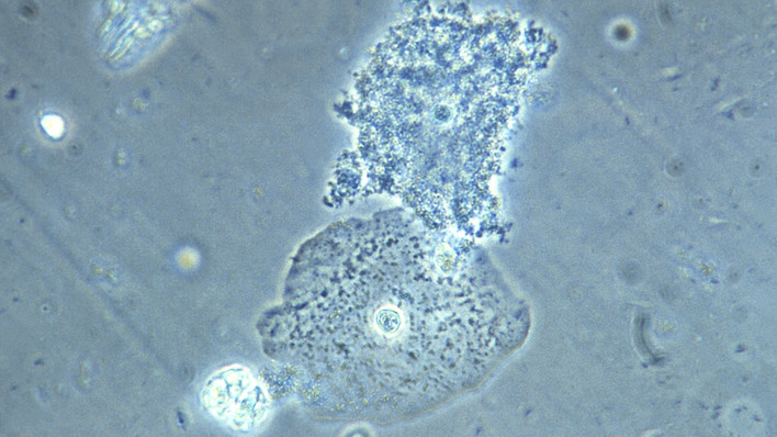 Lieferengpass bei Gynatren und Lyseen | APOTHEKE ADHOC