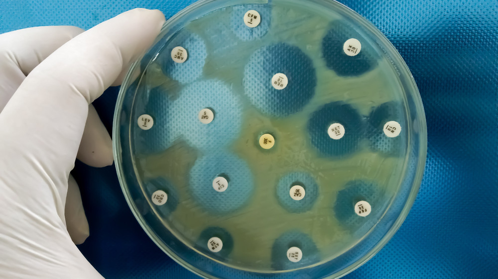 Recarbrio: Neues Antibiotikum bei Pneumonie | APOTHEKE ADHOC