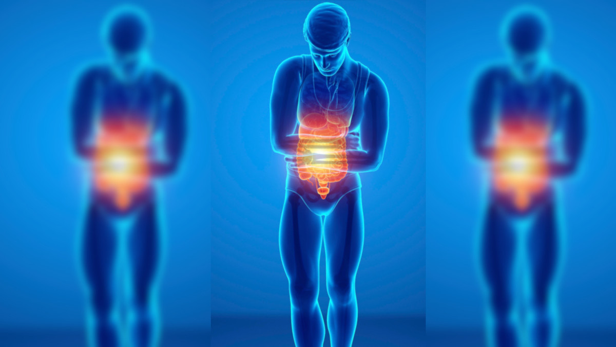 Rizmoic gegen Verstopfung | APOTHEKE ADHOC