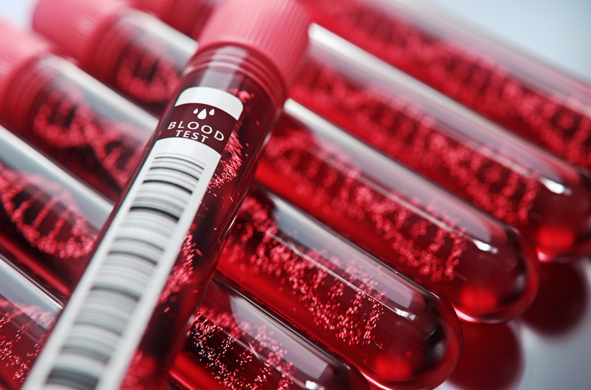 Zynteglo: Lebenslang ohne Blutransfusionen | APOTHEKE ADHOC