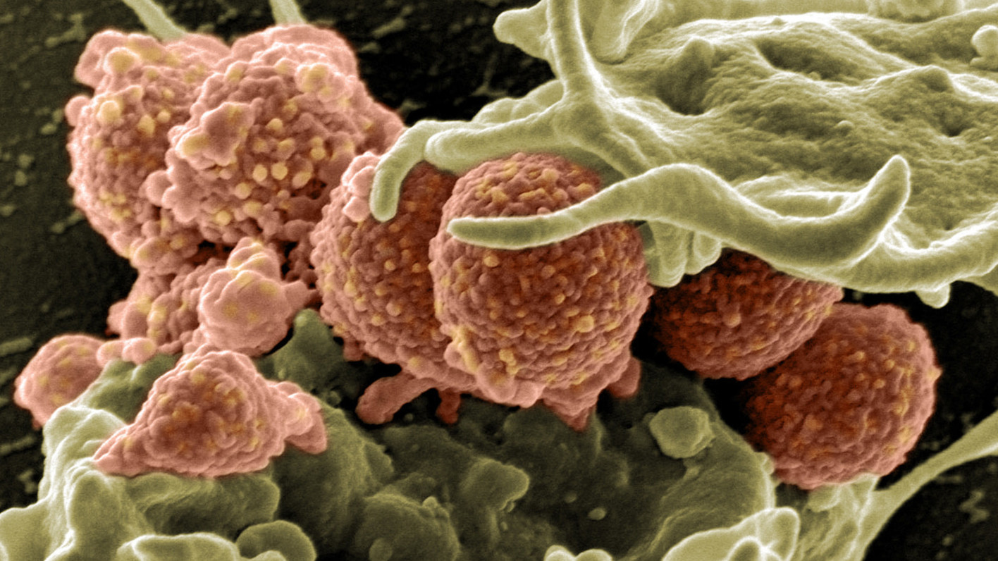 FDA prüft Zulasssung für Ceftobiprol | APOTHEKE ADHOC