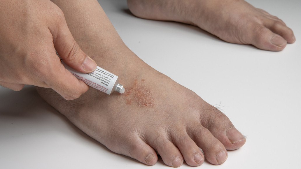 Bessere Wundheilung durch Betablocker-Gel? | APOTHEKE ADHOC