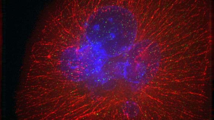 Nicht nur Beta-Zellen produzieren Insulin | APOTHEKE ADHOC