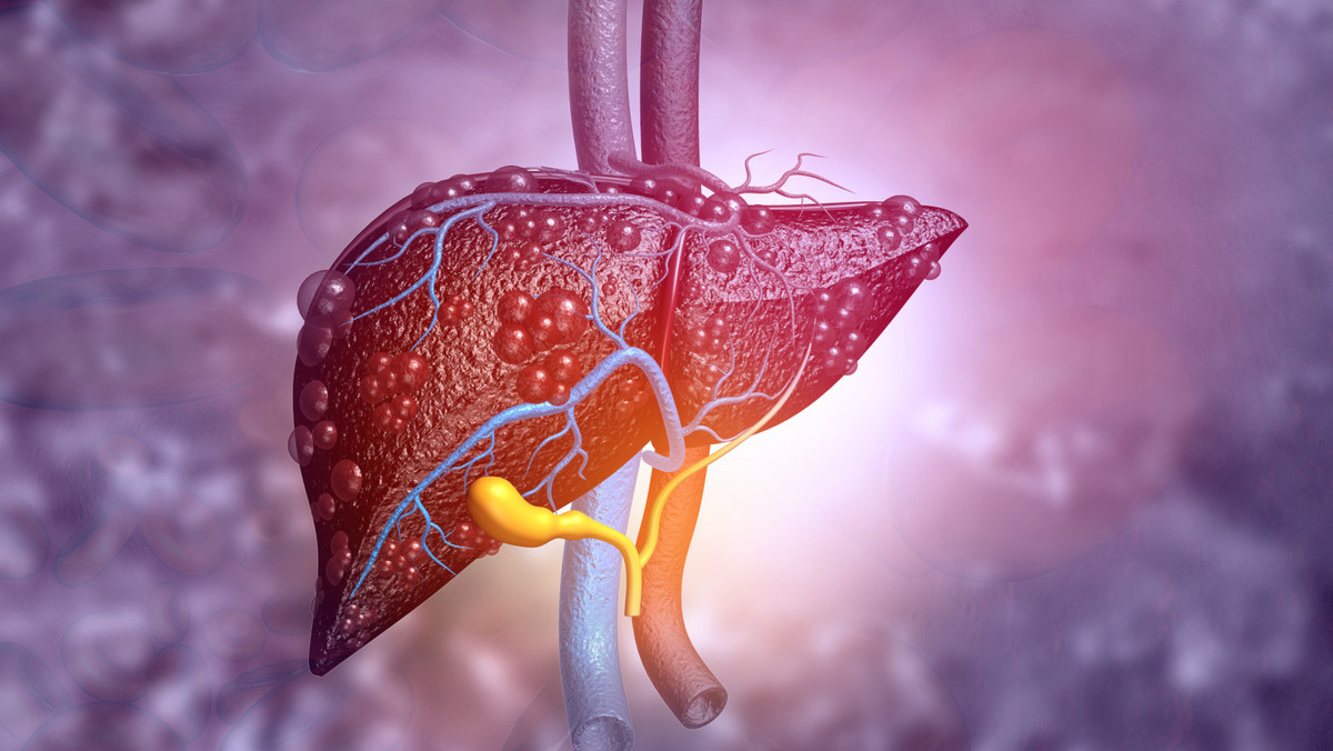 Hepcludex bei Hepatitis D | APOTHEKE ADHOC